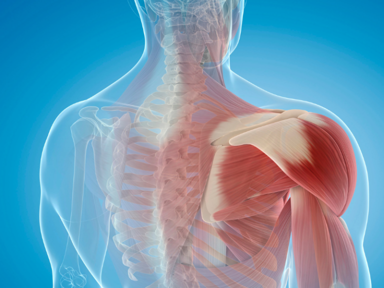 Upper Body Workout for Women to Reduce Broad Shoulders!