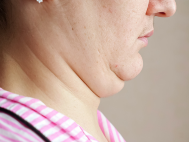 How to Lose Neck Fat: Exercises and Tips for a Slimmer Look